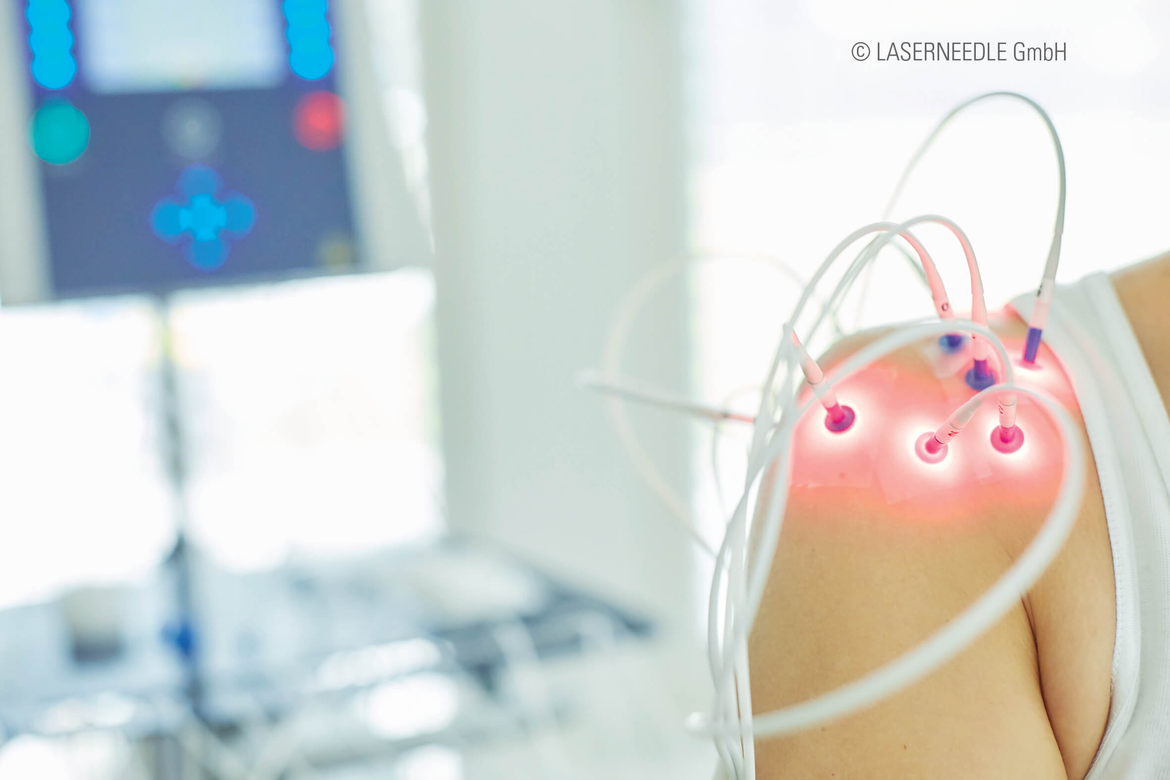 Laser therapy (low level laser) - Corpus