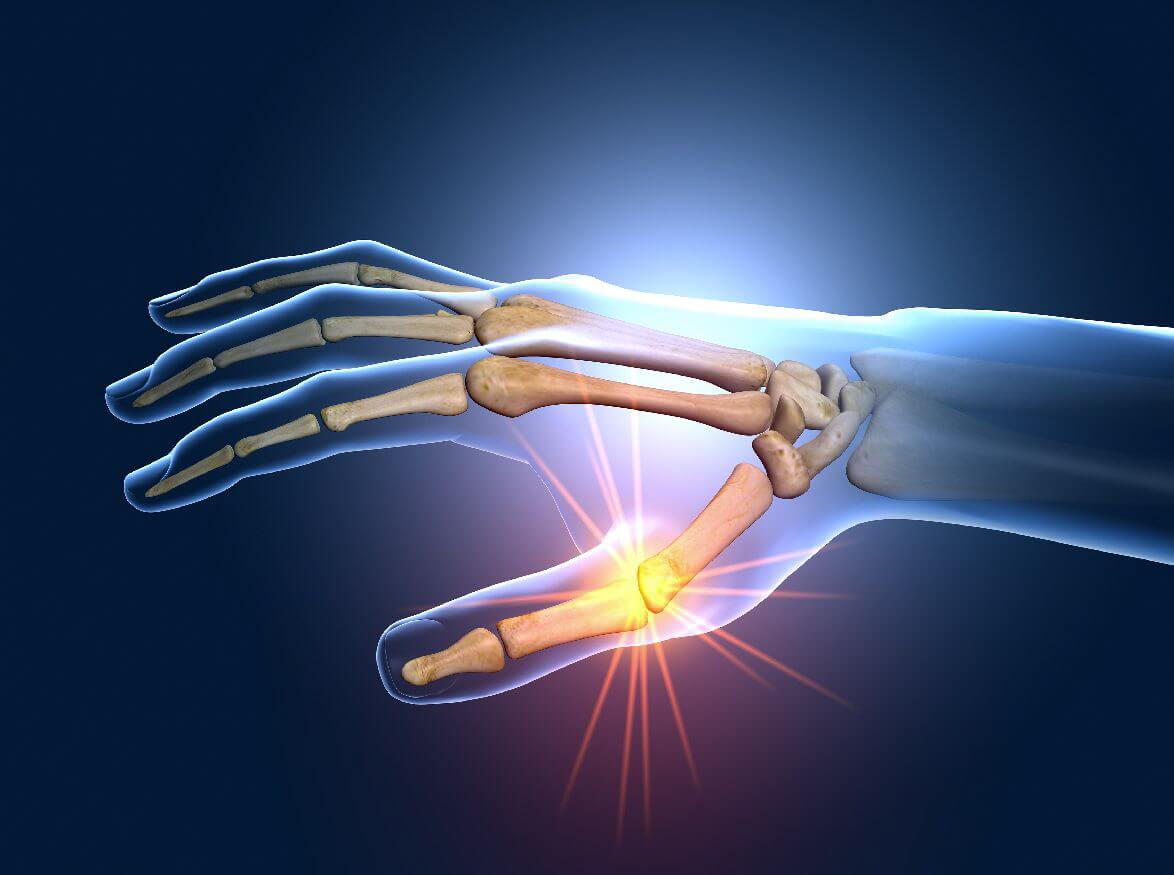 Orthopädische Operationen - Corpus